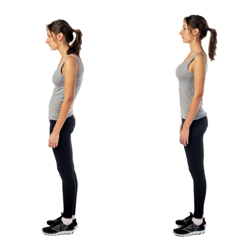 does-your-posture-need-improvement